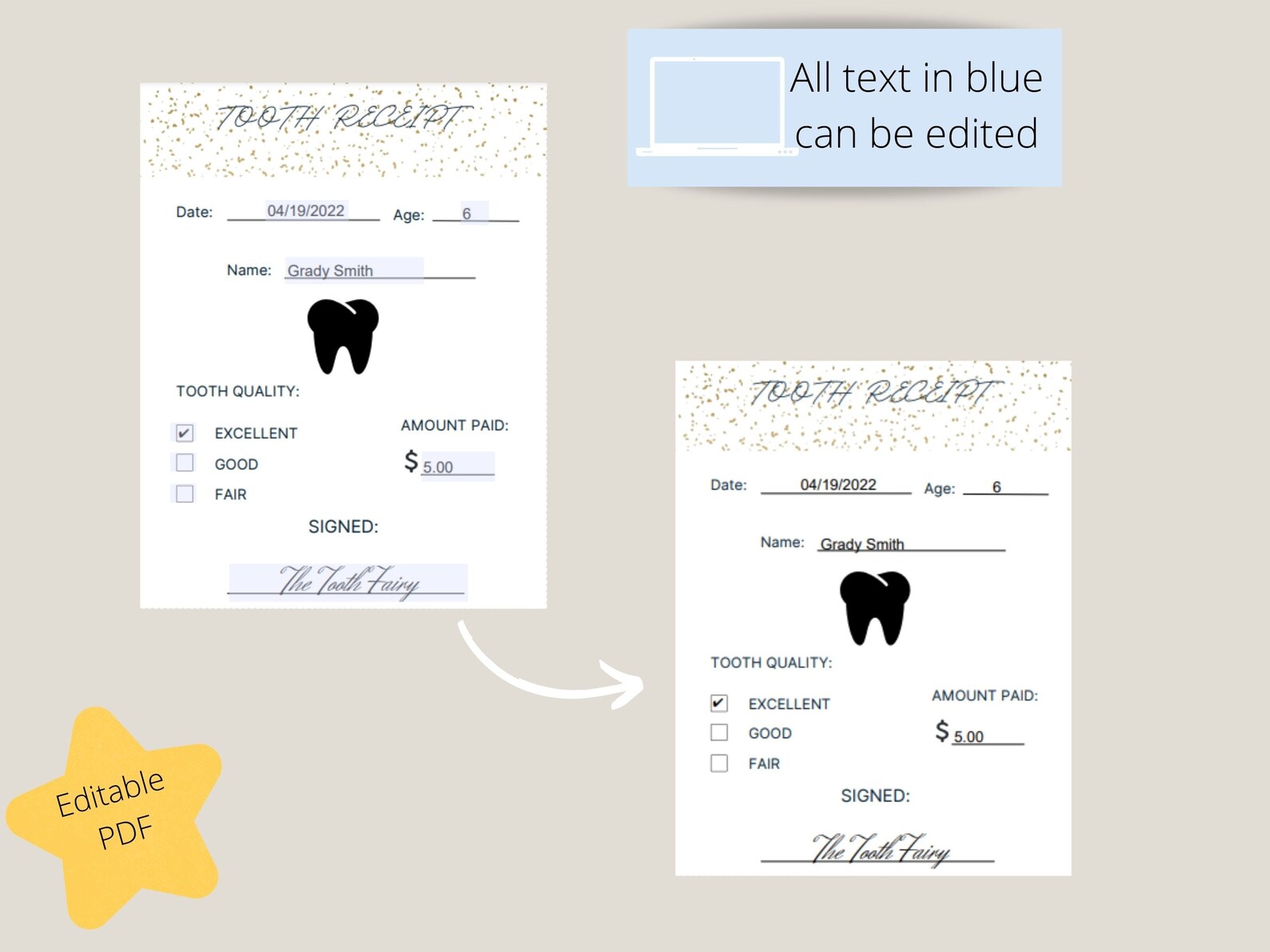 Tooth Receipt, Lost Tooth, Tooth Fairy Receipt, EDITABLE Tooth ...