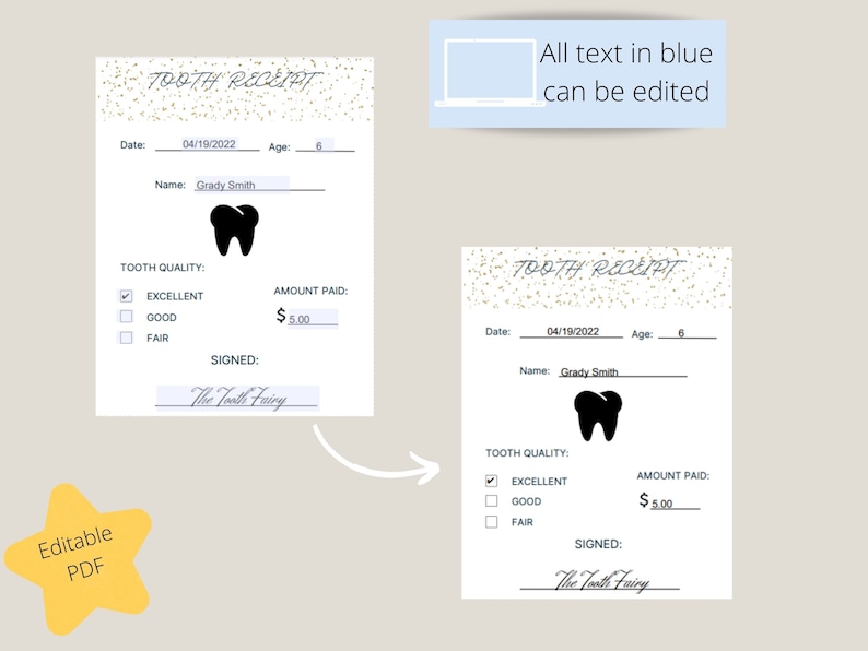 Tooth Receipt, Lost Tooth, Tooth Fairy Receipt, EDITABLE Tooth ...