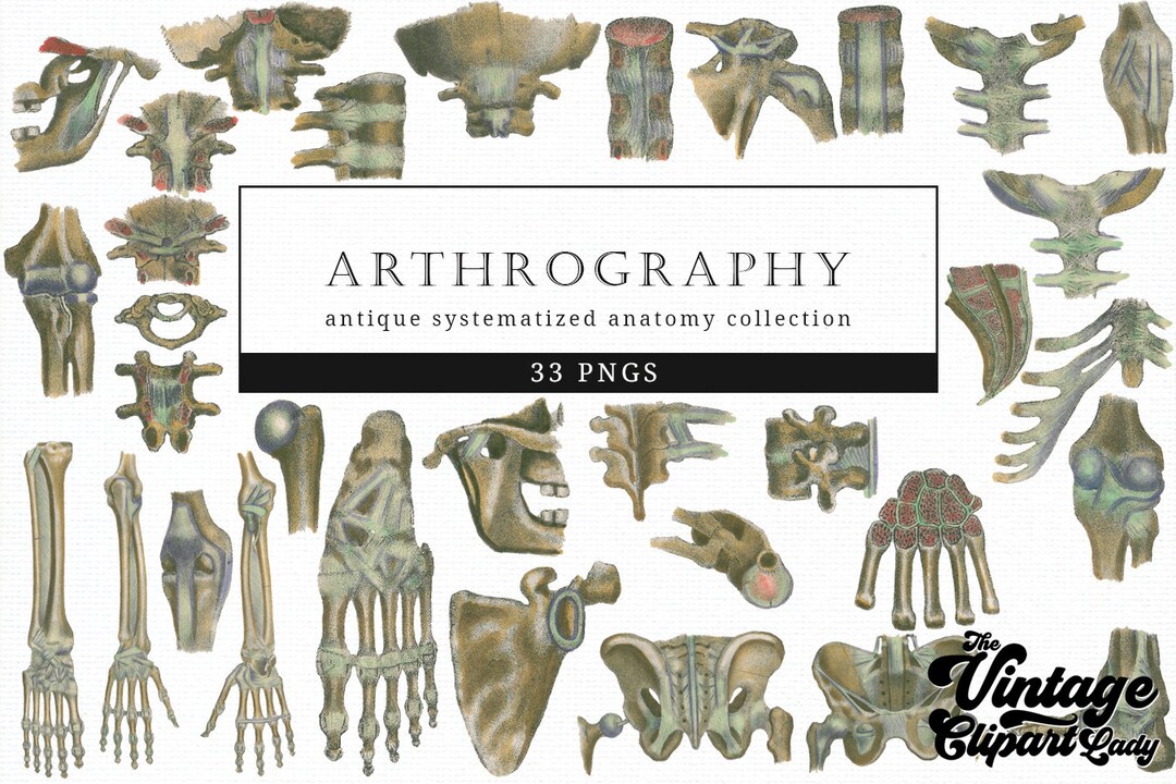 Arthrography Vintage Retro Human Body Bones Medical Illustration Clip ...