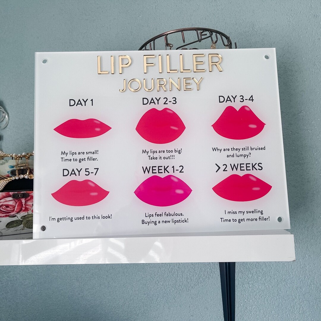 Lip Filler Journey Sign for the Wall, Stages of Healing, White ...
