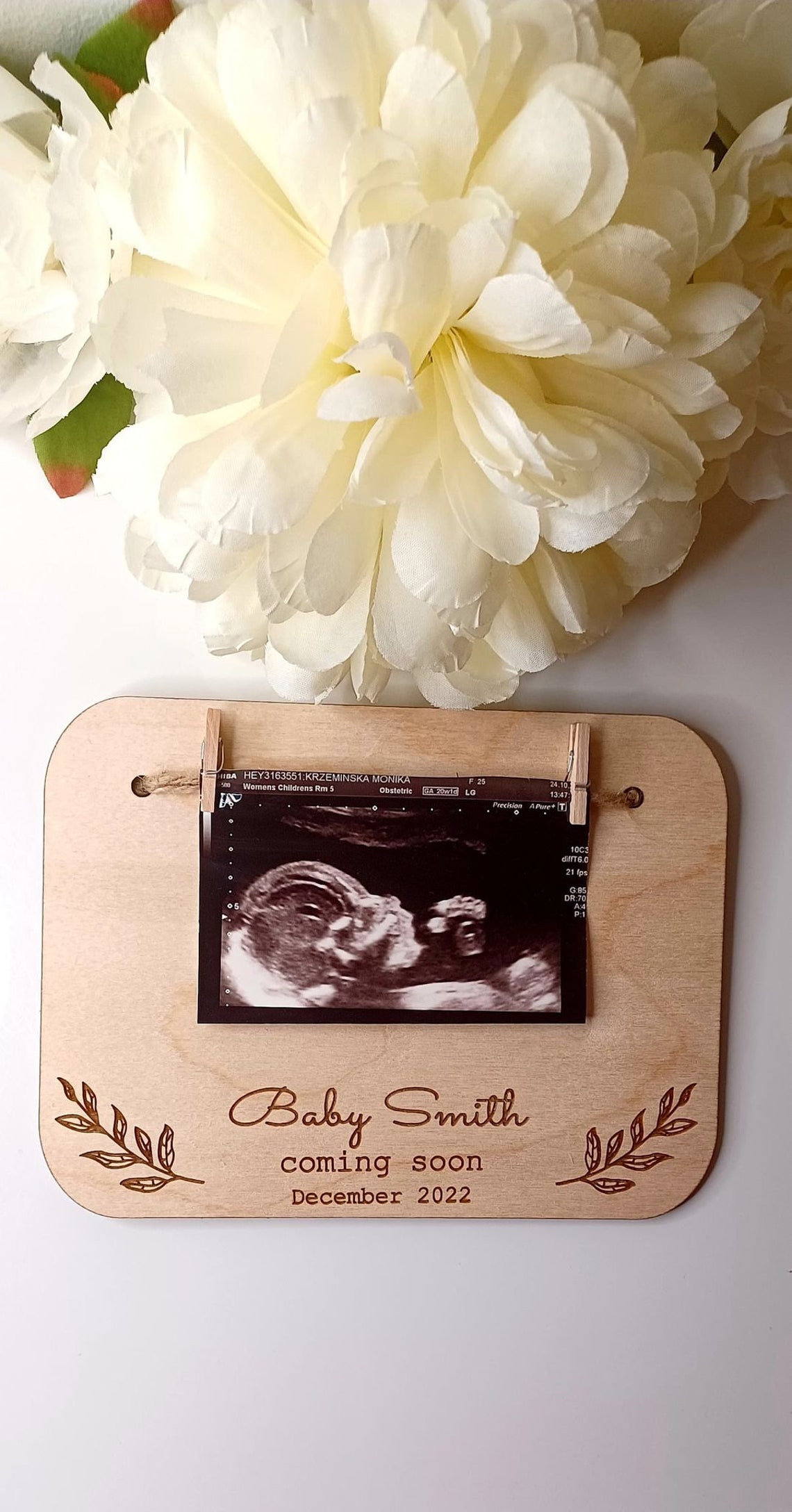 Baby Pregnancy Announcement Sign Baby Scan Wooden Sign Due - Etsy