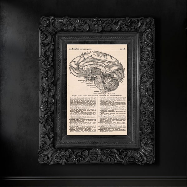 Vintage Brain Poster - Etsy