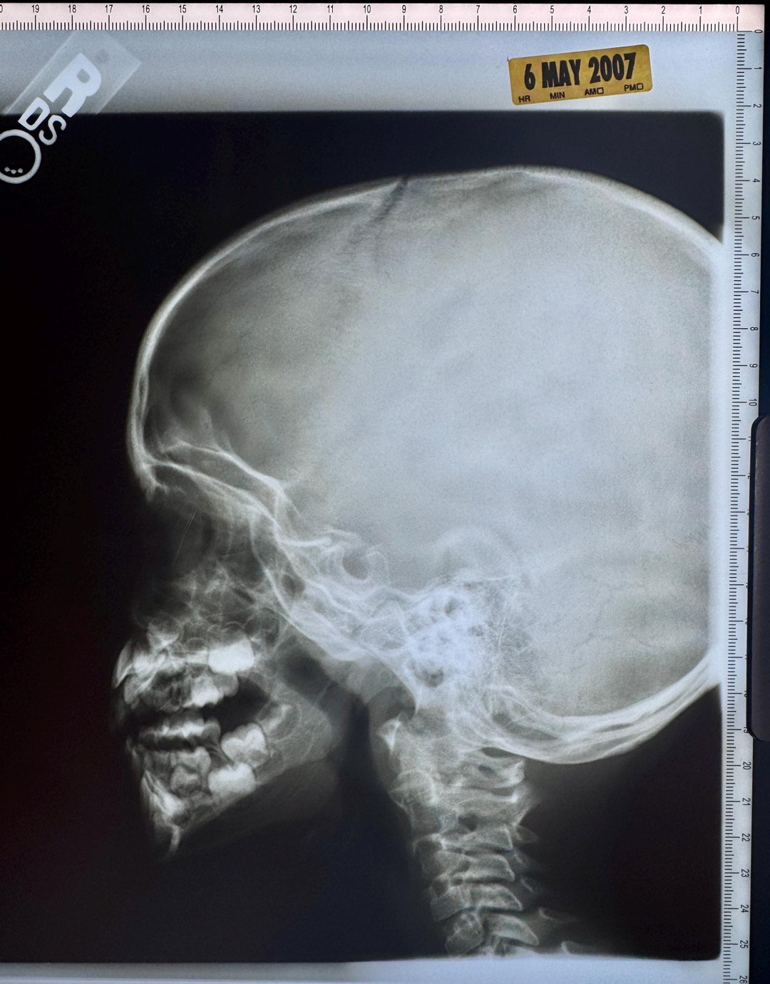 Real Human Head Bone Photo Films | Medical Education Curiosity Ephemera ...