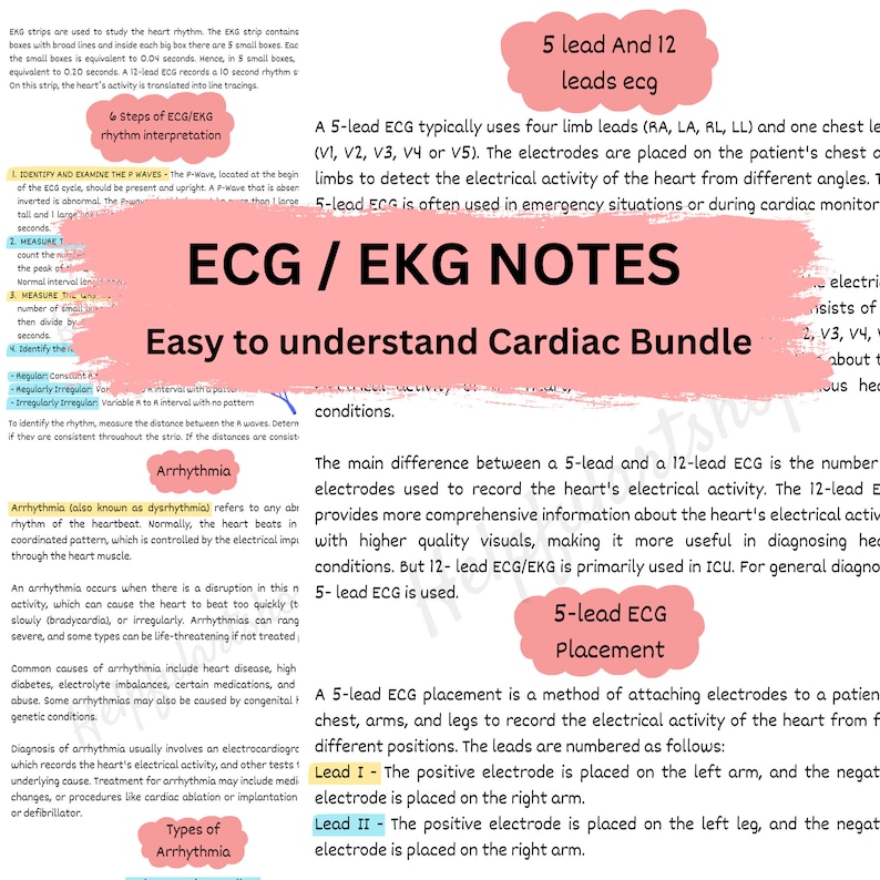 EKG Interpretation EKG Nursing Bundle Dysrhythmia & ECG Interpretation ...