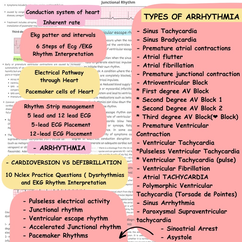 EKG Interpretation EKG Nursing Bundle Dysrhythmia & ECG Interpretation ...