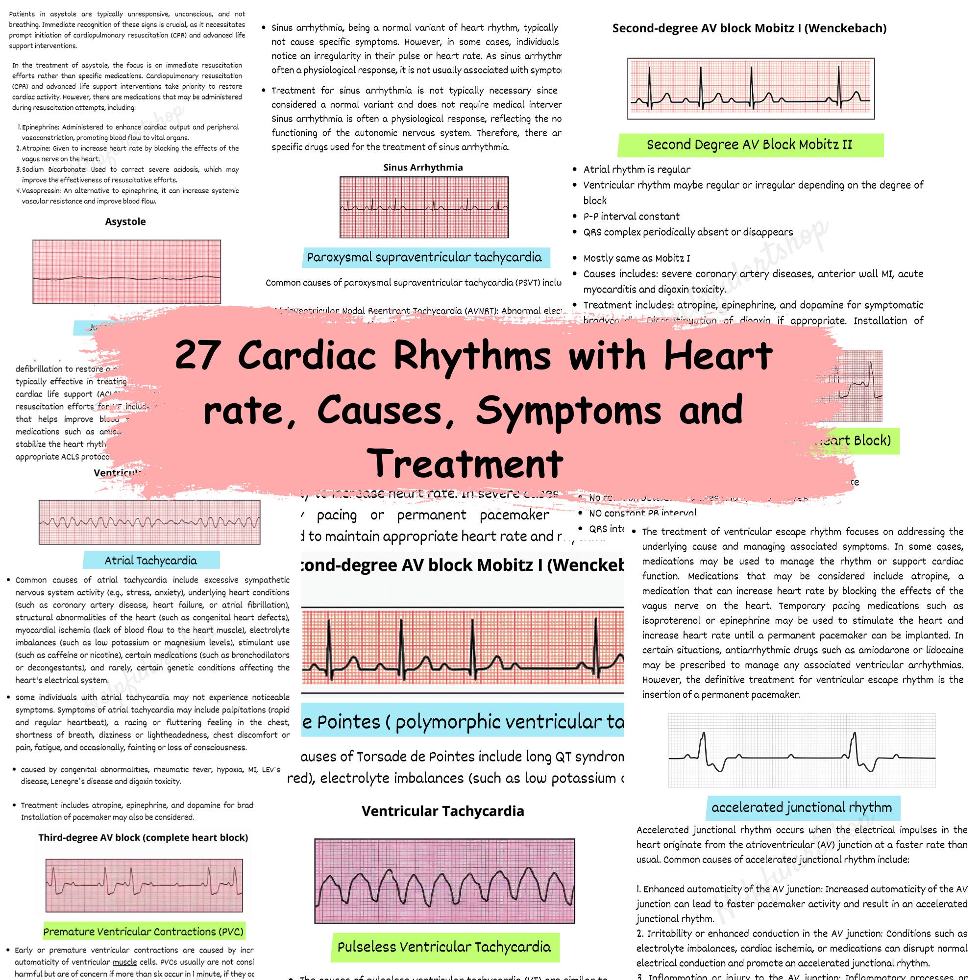 EKG Interpretation EKG Nursing Bundle Dysrhythmia & ECG Interpretation ...