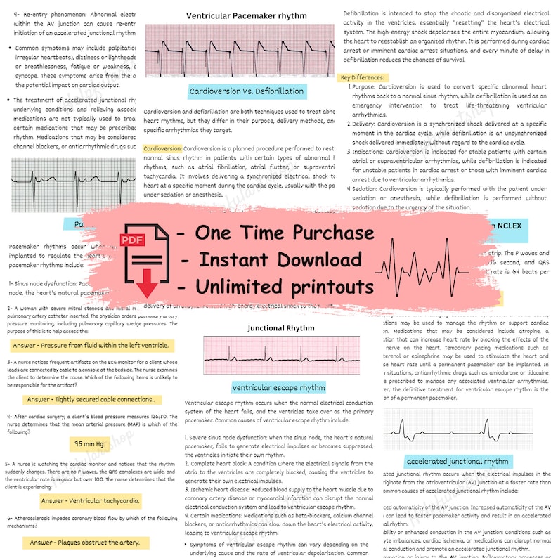 EKG Interpretation EKG Nursing Bundle Dysrhythmia & ECG Interpretation ...