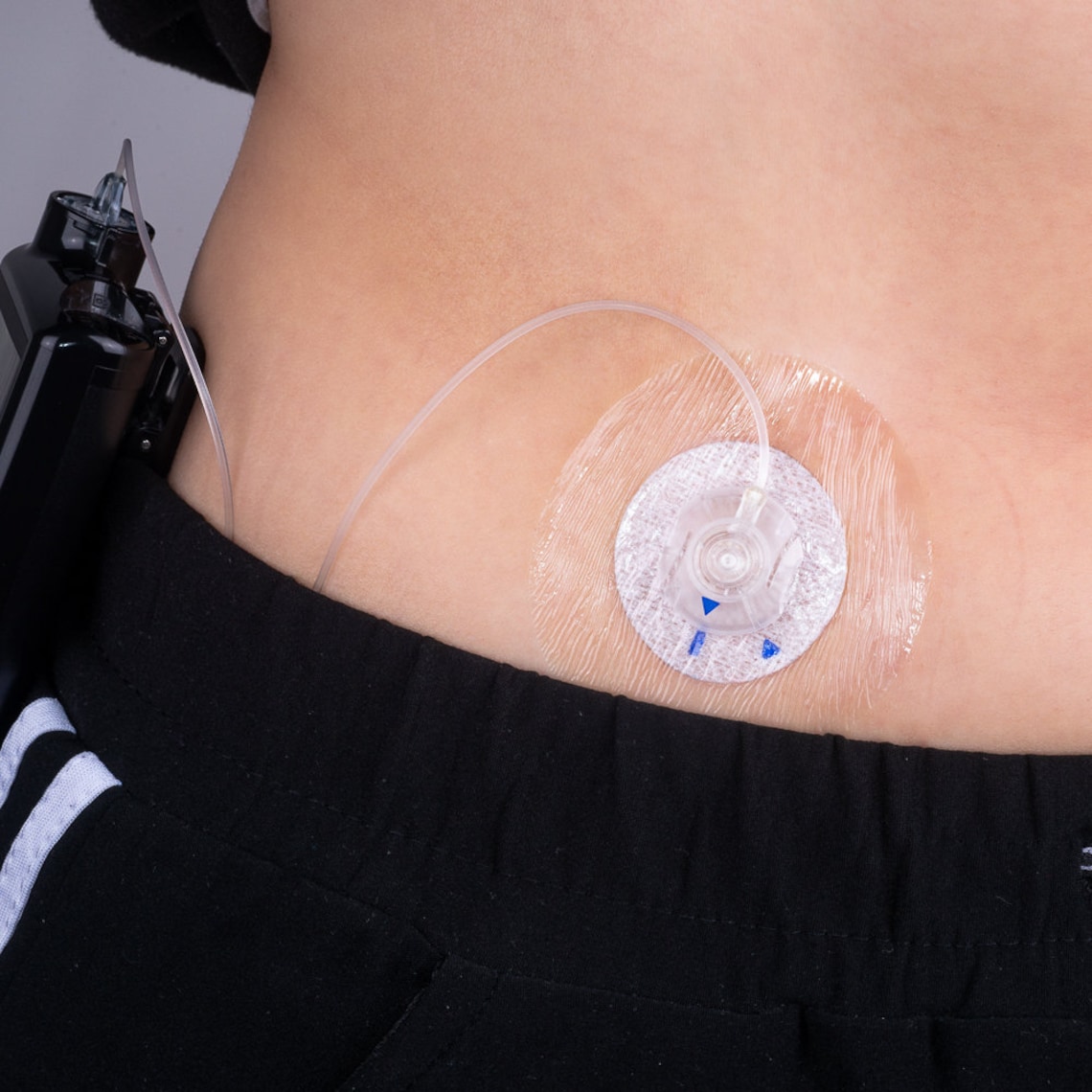 Medtronic Infusion Set Protective Transparent Patches - Diabetic ...