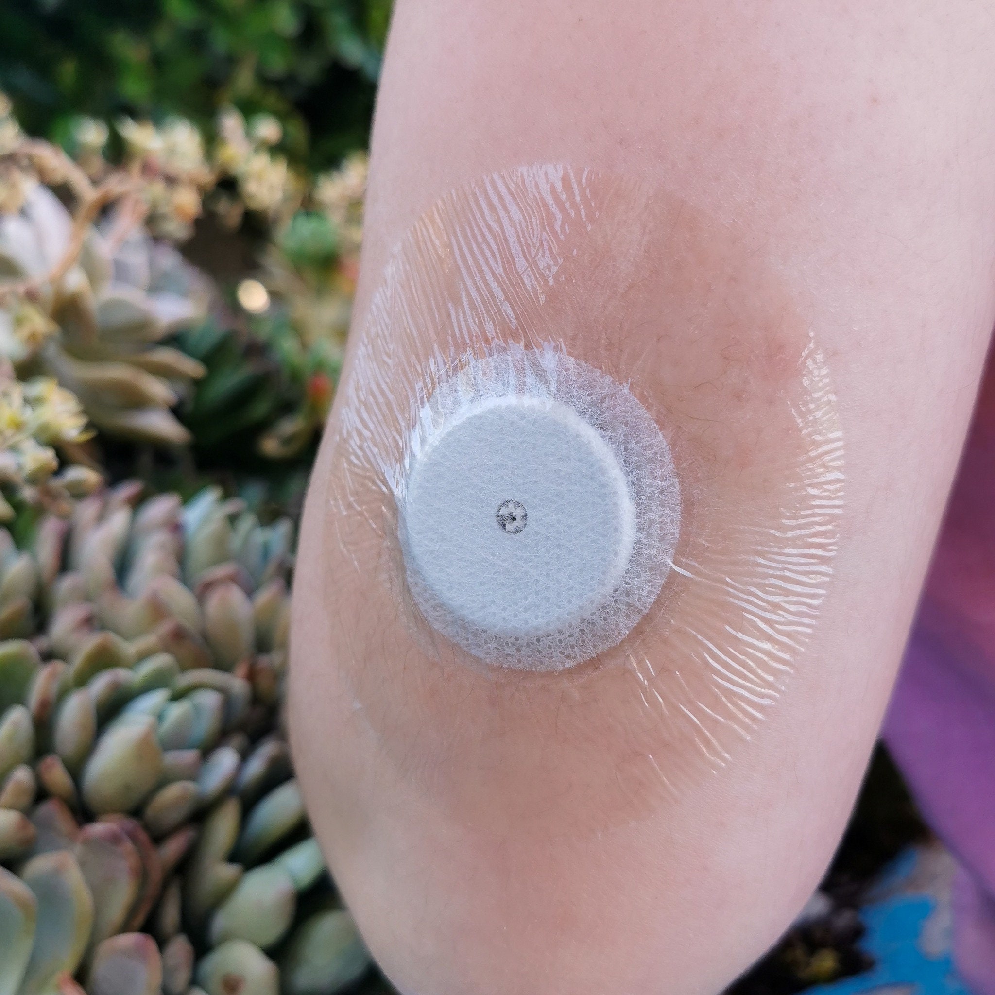 Freestyle Libre Transparent Patches Diabetic Patches Freestyle Libre 1 ...