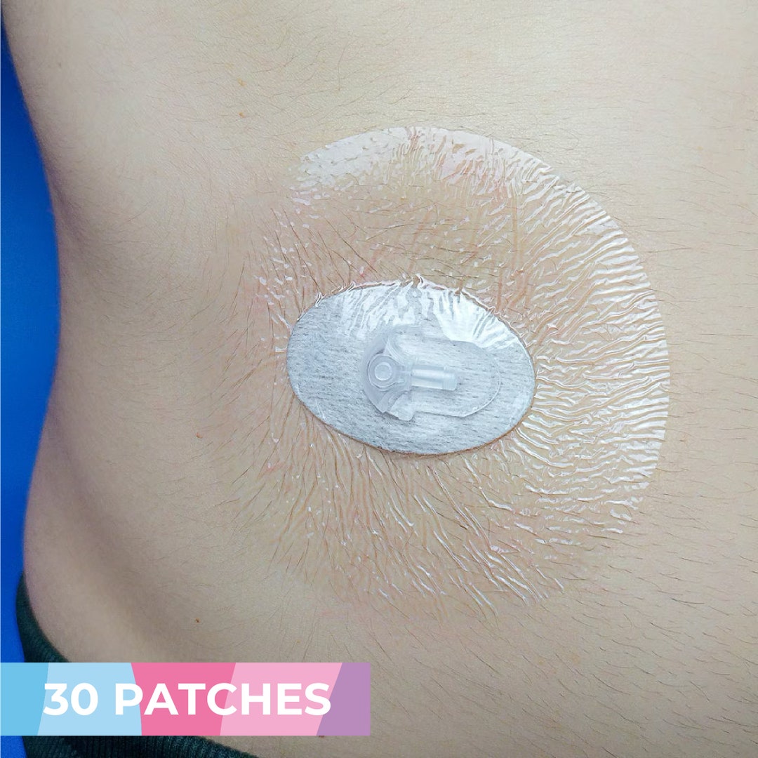Accu-chek Infusion Set Protective Transparent Patches - Diabetic ...