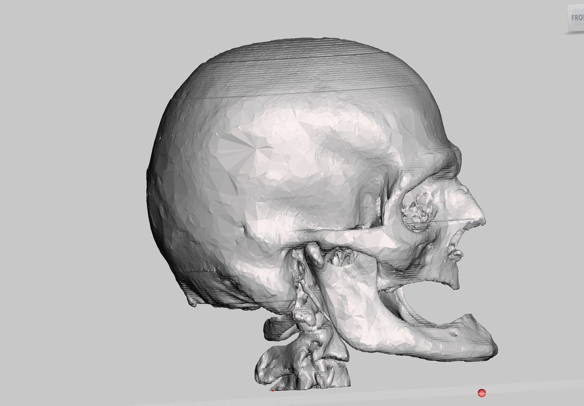 Unusual Male Skull, Edentulous (toothless), Quality High Resolution STL ...