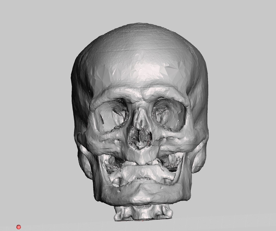 Unusual Male Skull, Edentulous (toothless), Quality High Resolution STL ...