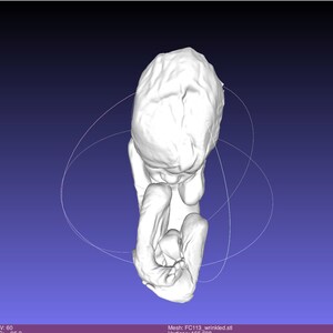 NEW!~ Rare High Resolution 3D Scan Human Fetus 14 Weeks Old 100 Yr Old ...