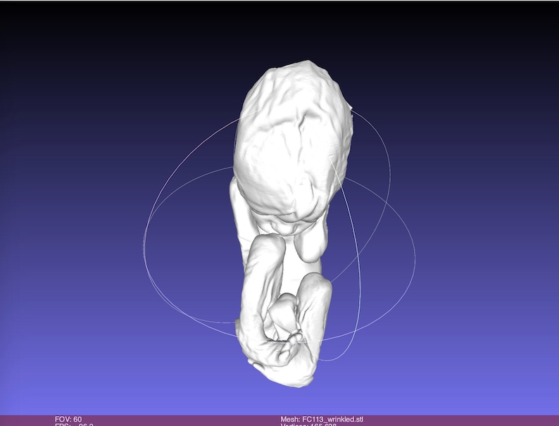 NEW!~ Rare High Resolution 3D Scan Human Fetus 14 Weeks Old 100 Yr Old ...