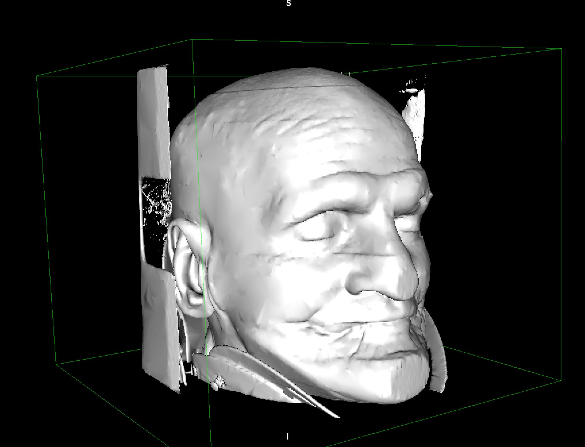 Unusual Male Skull, Edentulous (toothless), Quality High Resolution STL ...
