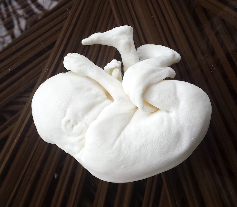 Rare High Resolution 3D Scan Human Fetus 26 Weeks Old, #1 - Etsy