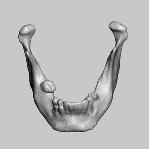 African American Male Skull and Jaw, LARGE Inion Hook (modern Human CT ...