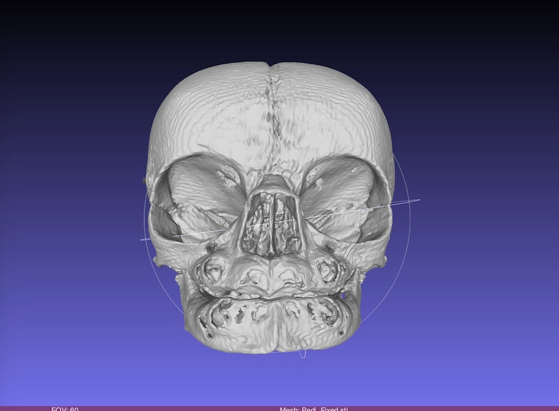 5 Month Old Human Skull (victorian Child, CT SCAN), Museum Quality High ...