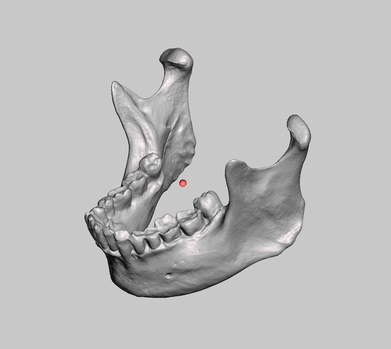 African American Male Skull and Jaw, Near PERFECT (modern Human CT Scan ...
