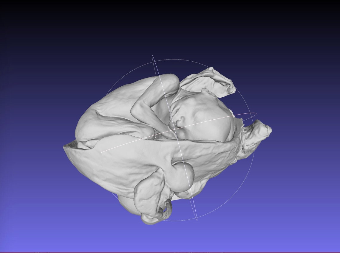 Cutaway View Human Fetus in Utero, 20 Week Old STL, Rare High ...