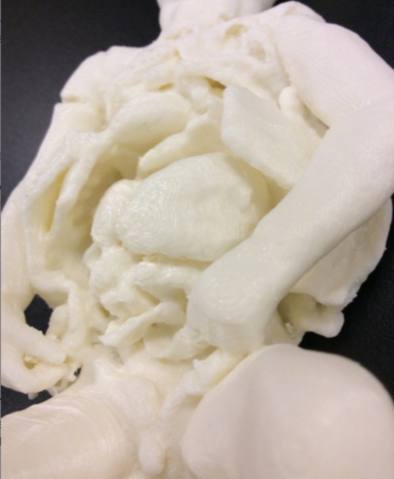 CYCLOPS Rare High Resolution 3D Scan Human Fetus 36 Weeks Old - Etsy