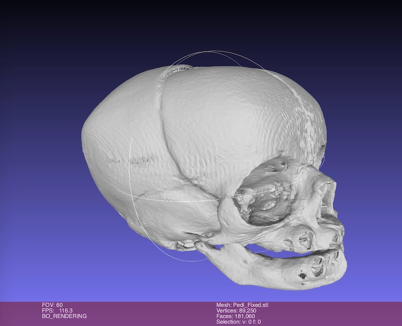 5 Month Old Human Skull (victorian Child, CT SCAN), Museum Quality High ...