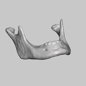 African American Male Skull and Jaw, AMAZINGLY Round (modern Human CT ...