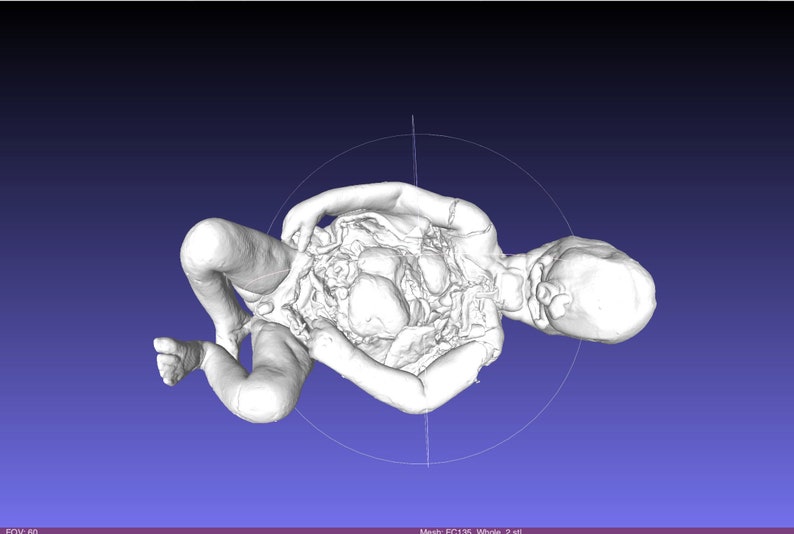 CYCLOPS Rare High Resolution 3D Scan Human Fetus 36 Weeks Old ...