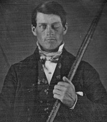 Phineas Gage Skull, (harvard CT SCAN), Museum Quality High Resolution ...