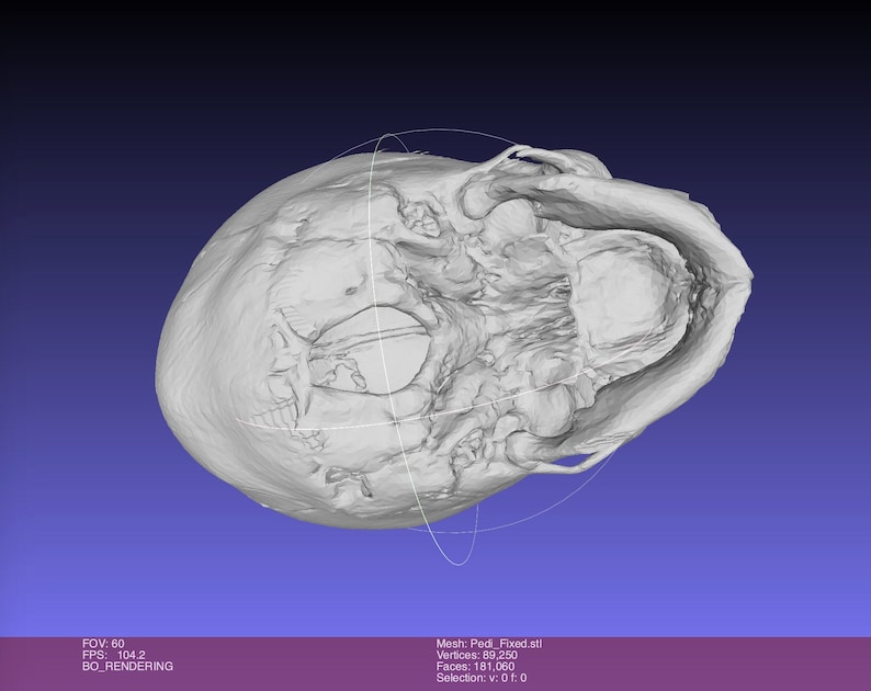 5 Month Old Human Skull (victorian Child, CT SCAN), Museum Quality High ...
