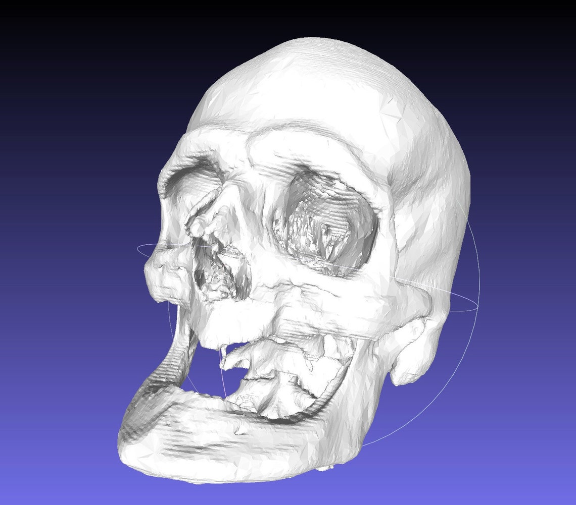 Unusual Male Skull, Edentulous (toothless), Quality High Resolution STL ...