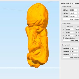 NEW!~ Rare High Resolution 3D Scan Human Fetus 14 Weeks Old 100 Yr Old ...