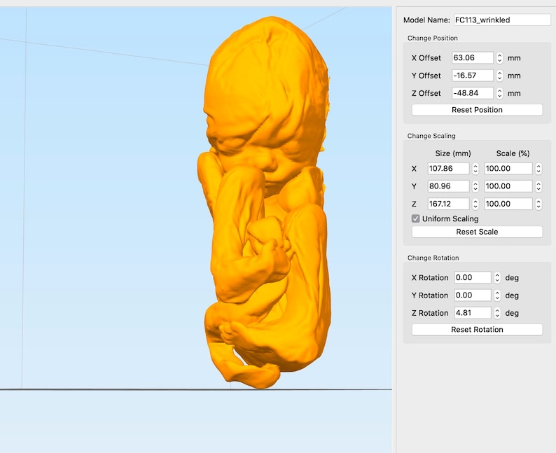 NEW!~ Rare High Resolution 3D Scan Human Fetus 14 Weeks Old 100 Yr Old ...