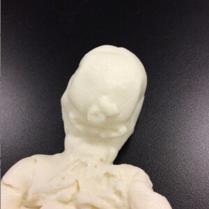 CYCLOPS Rare High Resolution 3D Scan Human Fetus 36 Weeks Old ...