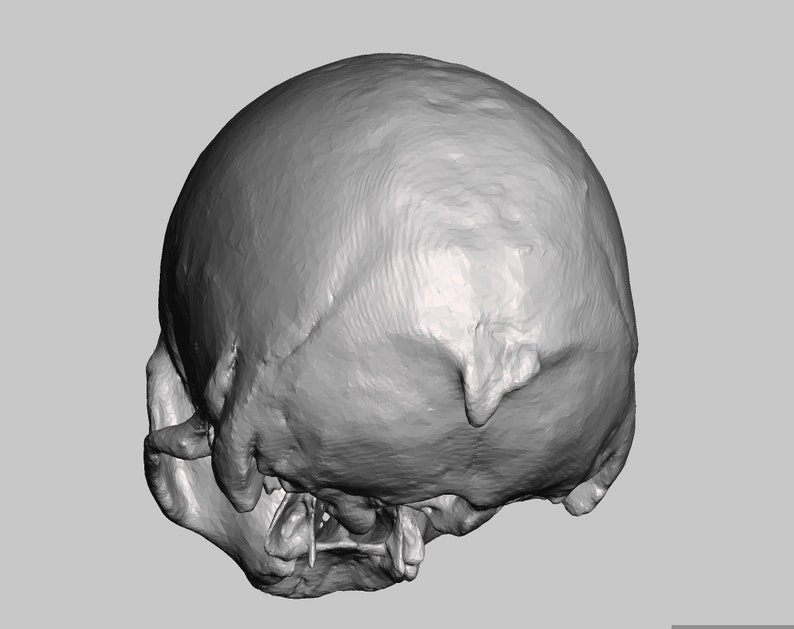 African American Male Skull and Jaw, LARGE Inion Hook (modern Human CT ...