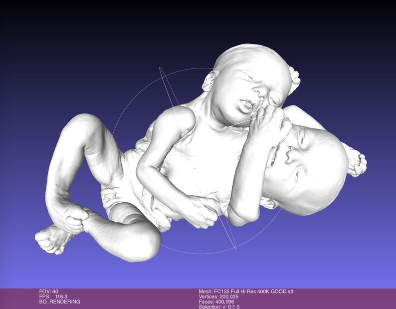 NEW Rare High Resolution 3D Scan of 36 Week Old Human Twin Fetus, W ...