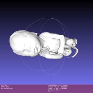 NEW!~ Rare High Resolution 3D Scan Human Fetus 16 Weeks Old 100 Yr Old ...