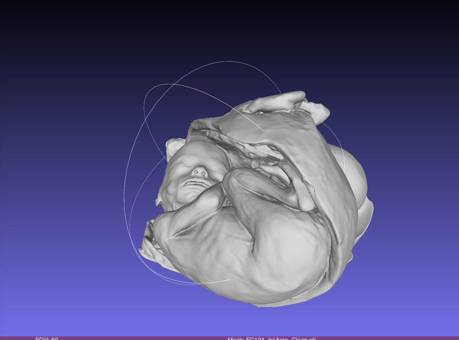 Cutaway View Human Fetus in Utero, 20 Week Old STL, Rare High ...