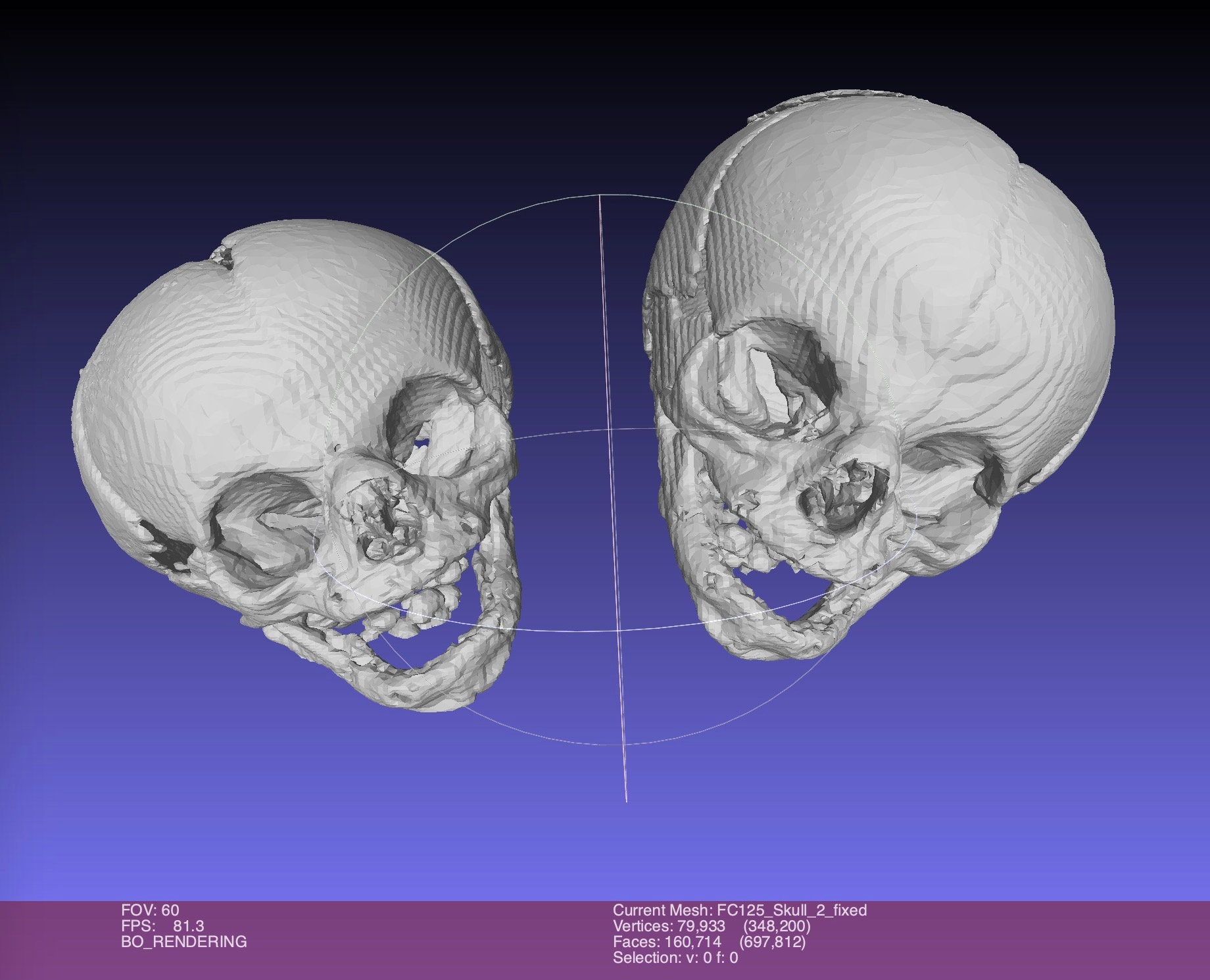 NEW Rare High Resolution 3D Scan of 36 Week Old Human Twin - Etsy