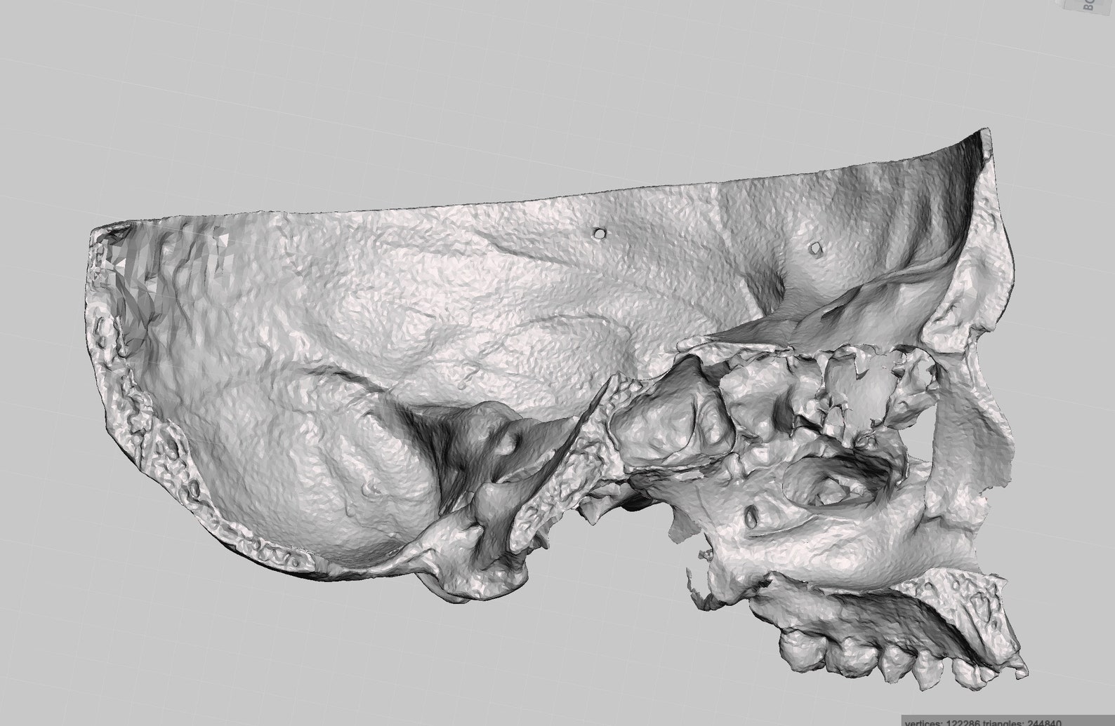 Human Skull STL, Cut in HALF. Teaching Tool Used in Forensic ...
