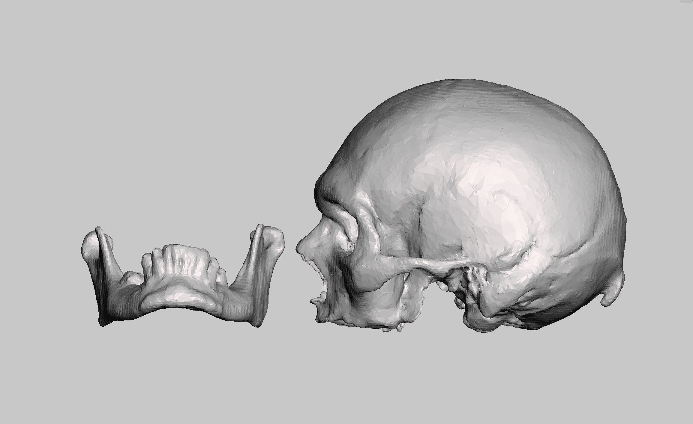 African American Male Skull and Jaw, LARGE Inion Hook (modern Human CT ...