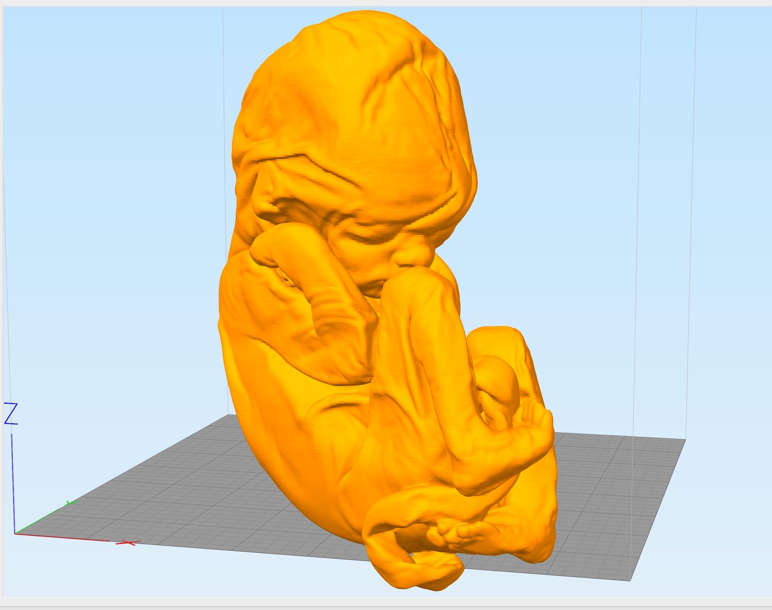 NEW!~ Rare High Resolution 3D Scan Human Fetus 14 Weeks Old 100 Yr Old ...