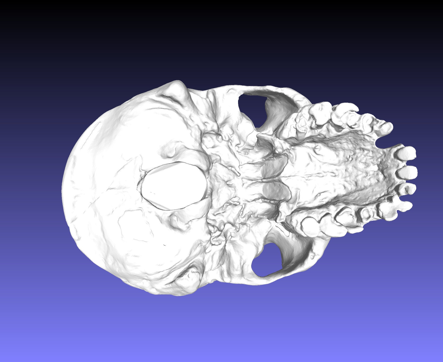 Homo Heidelbergensis, Broken Hill Skull, Ancient Hominid Skull Museum ...