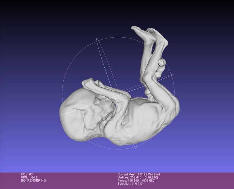 NEW Rare High Resolution 3D Scan Human Fetus 16-20 Weeks Old 100 Yr Old ...