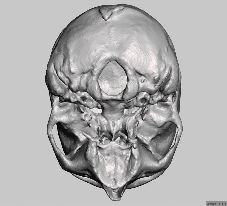 African American Male Skull and Jaw, LARGE Inion Hook (modern Human CT ...