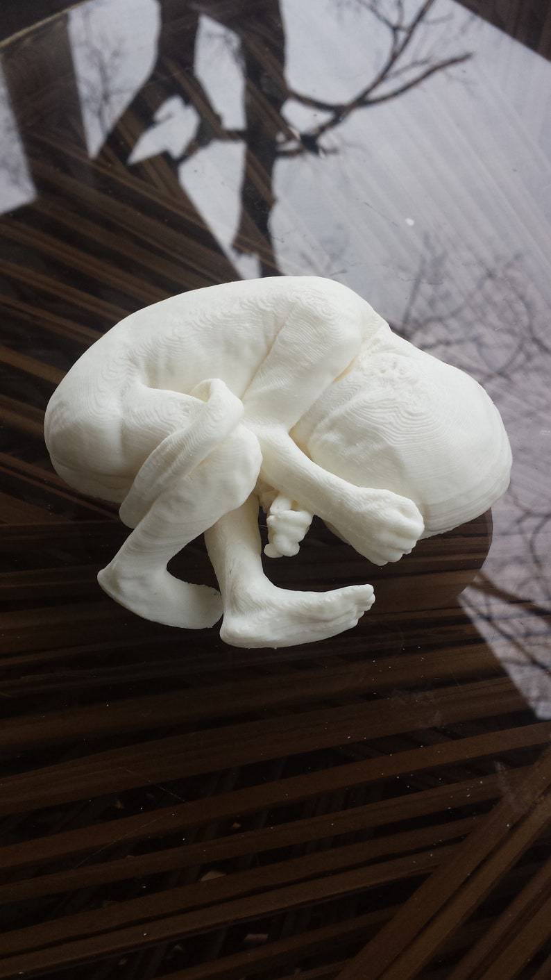 Rare High Resolution 3D Scan Human Fetus 26 Weeks Old 1 - Etsy UK