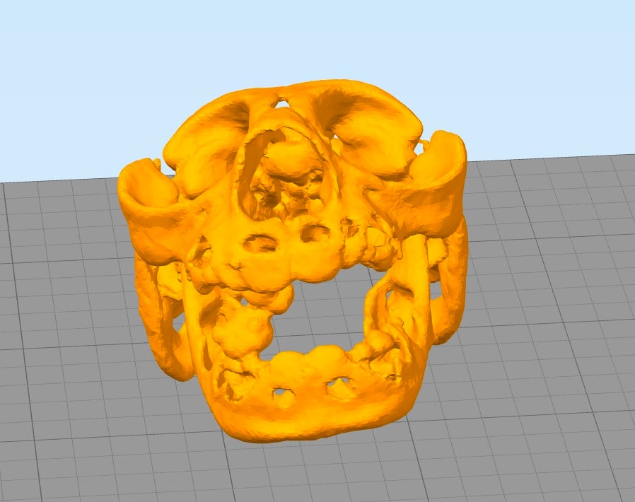 Anacephalic Rare High Resolution 3D Scan Human Fetus SKULL 36 - Etsy