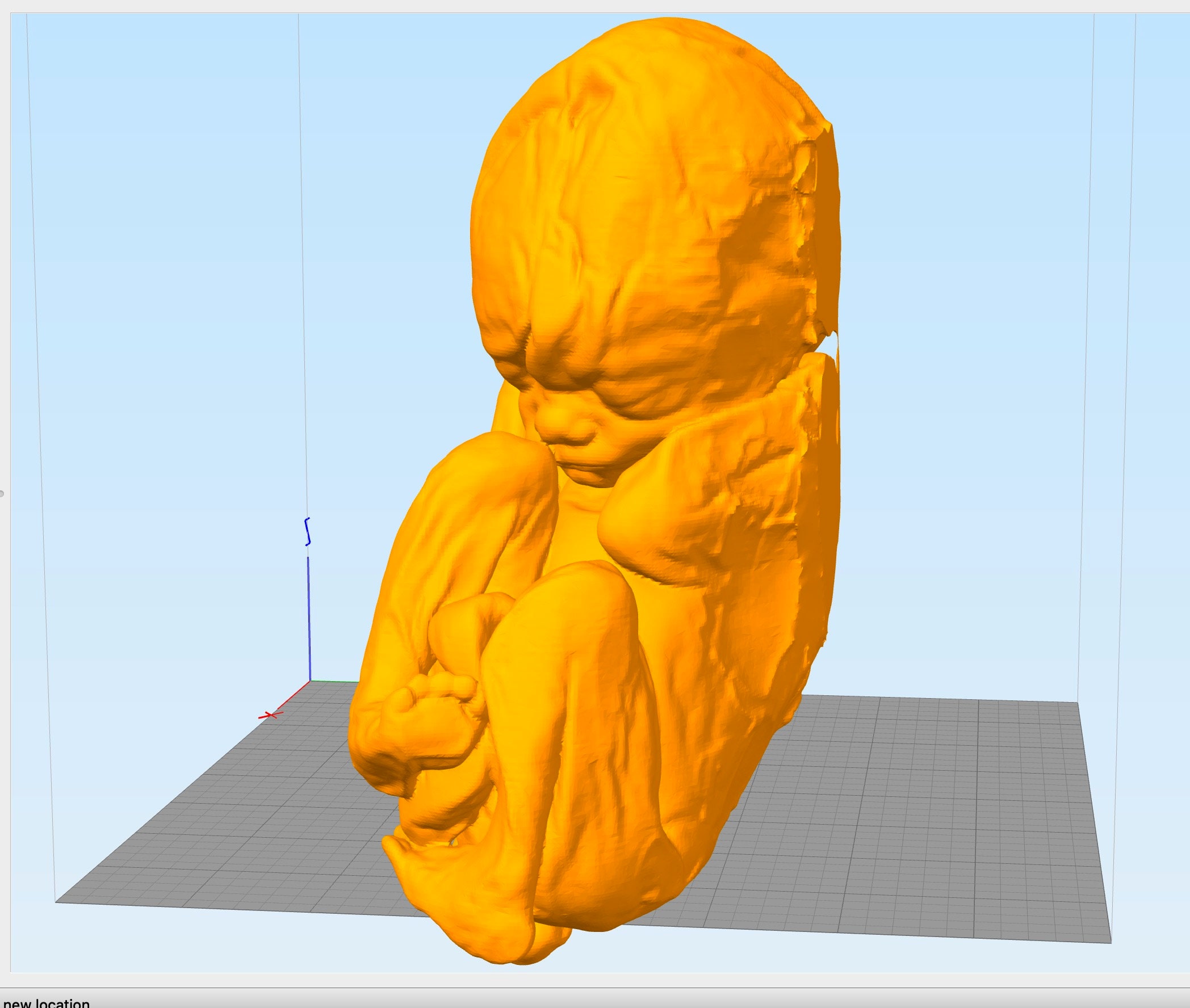 NEW!~ Rare High Resolution 3D Scan Human Fetus 14 Weeks Old 100 Yr Old ...
