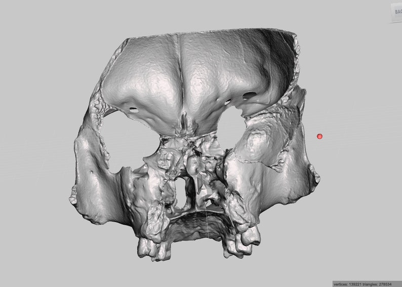 African Skull STL, Cut in HALF. Teaching Tool Used in Forensic ...