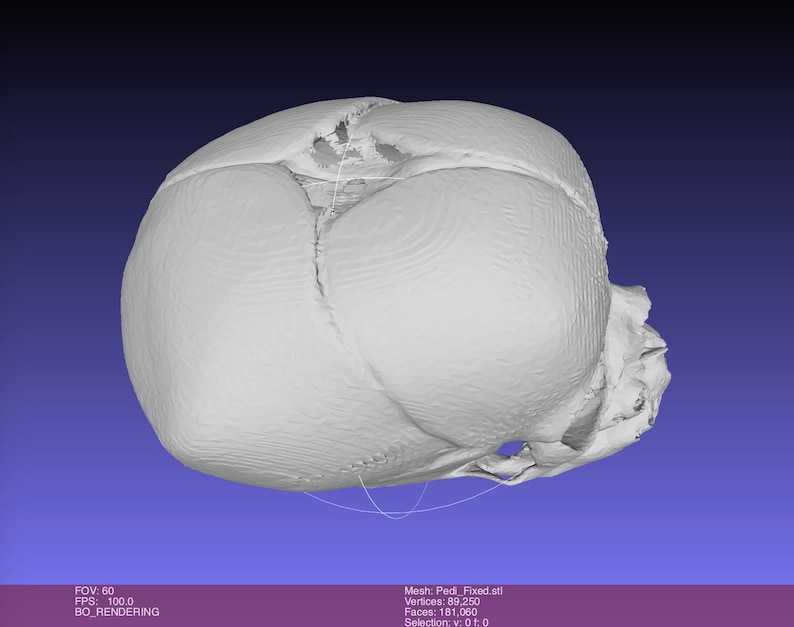 5 Month Old Human Skull (victorian Child, CT SCAN), Museum Quality High ...
